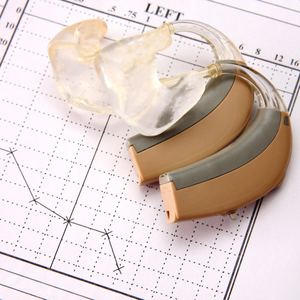 The Complete Guide to Ear Impressions: Everything to Know